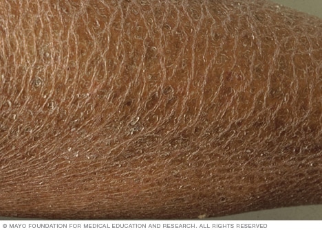 St. Elizabeth Healthcare - Condition